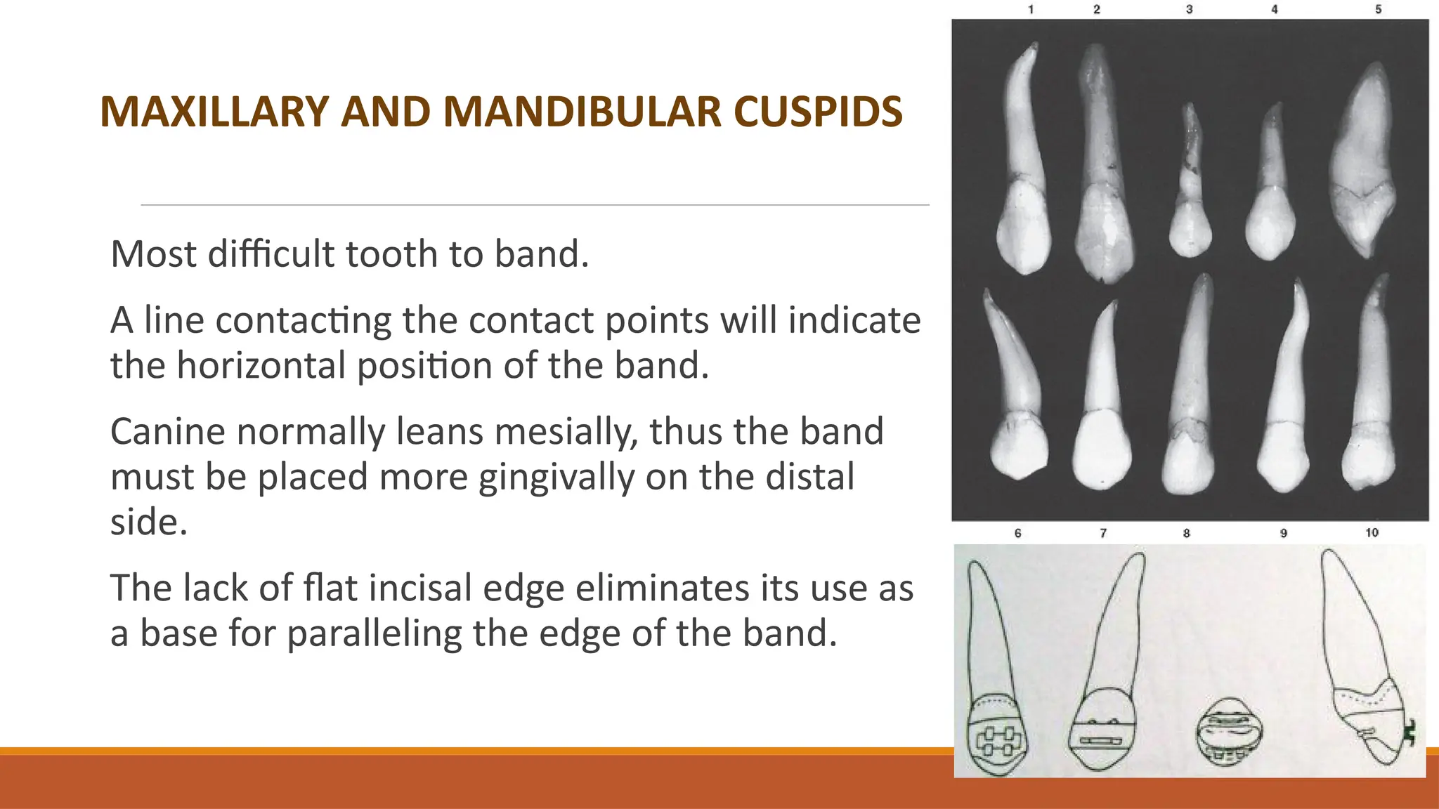 ORTHO BANDS.pptx vgghj hgjbk bk bjk j nk,n,jk | PPT