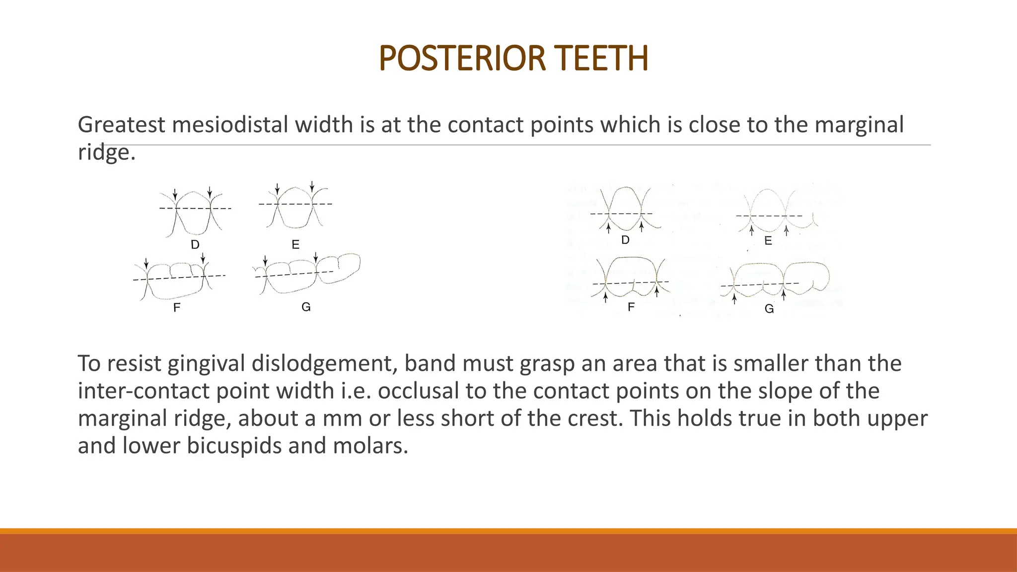 ORTHO BANDS.pptx vgghj hgjbk bk bjk j nk,n,jk | PPT