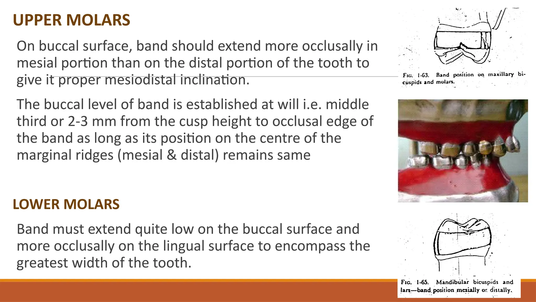 ORTHO BANDS.pptx vgghj hgjbk bk bjk j nk,n,jk | PPT