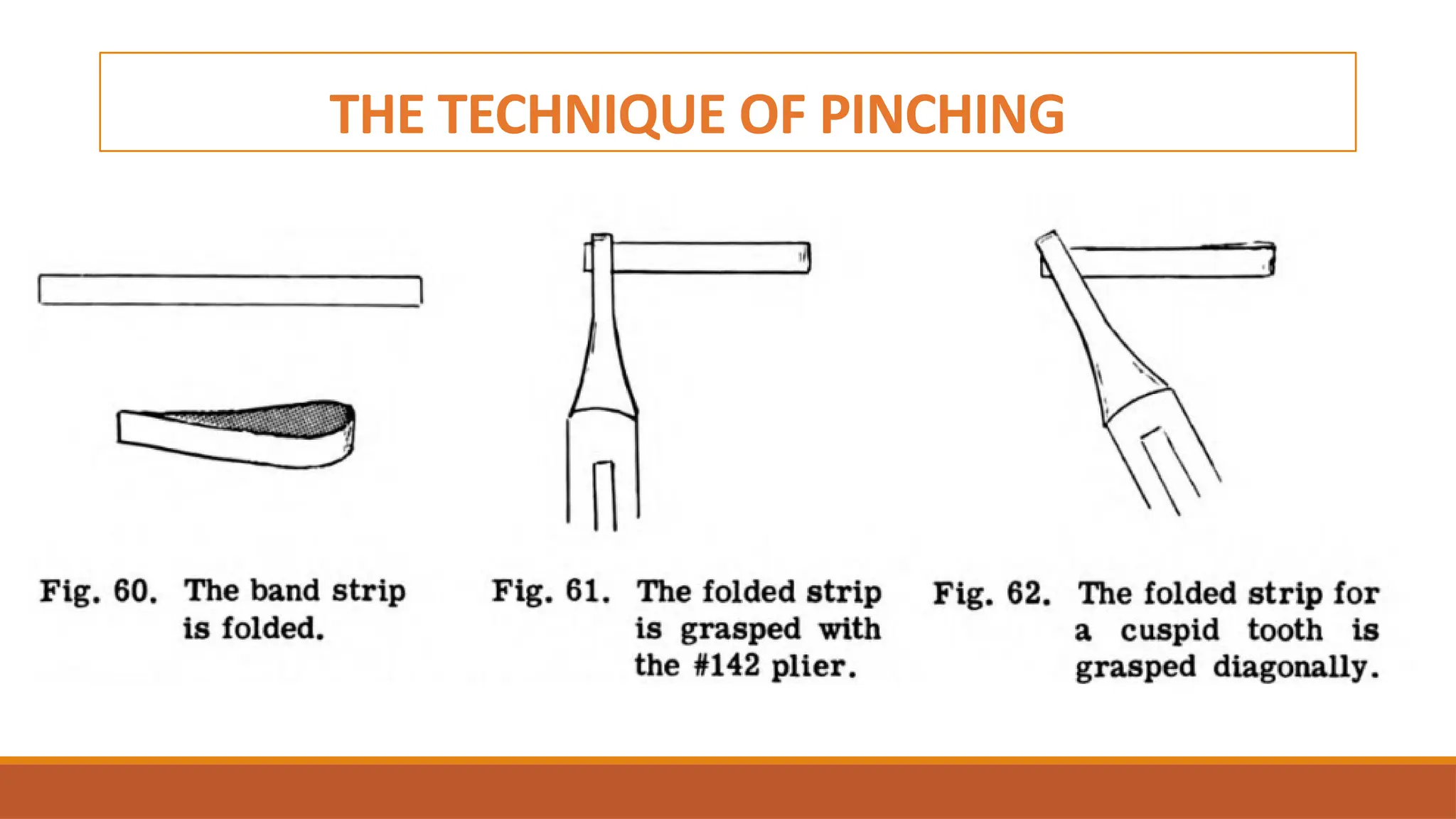 ORTHO BANDS.pptx vgghj hgjbk bk bjk j nk,n,jk | PPT