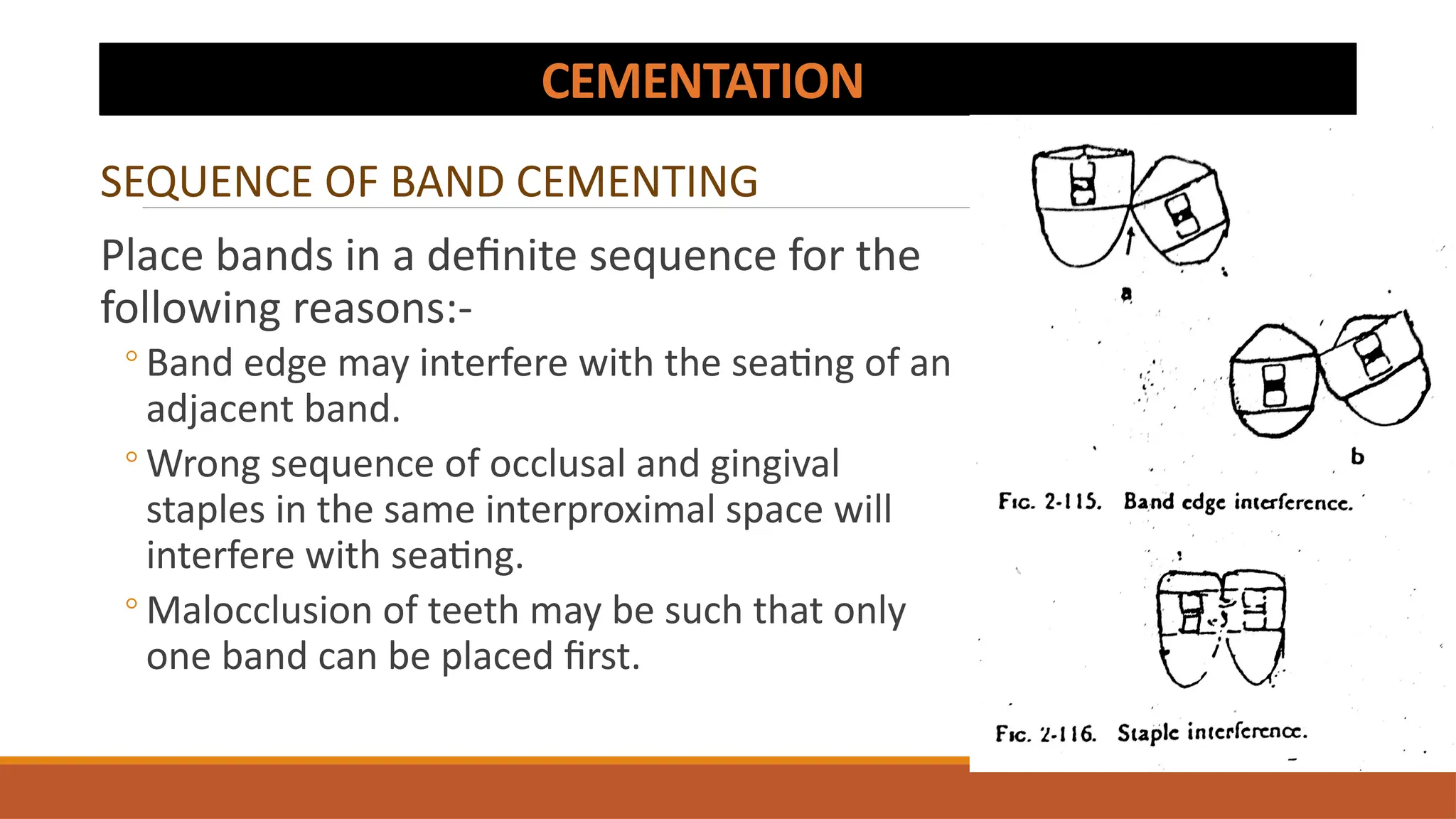 ORTHO BANDS.pptx vgghj hgjbk bk bjk j nk,n,jk | PPT