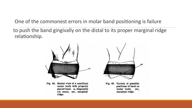 ORTHO BANDS.pptx vgghj hgjbk bk bjk j nk,n,jk | PPT