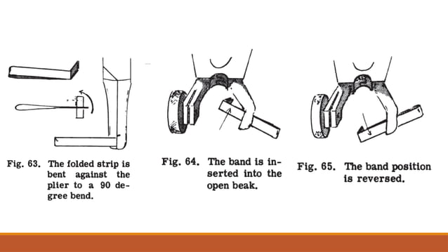 ORTHO BANDS.pptx vgghj hgjbk bk bjk j nk,n,jk | PPT
