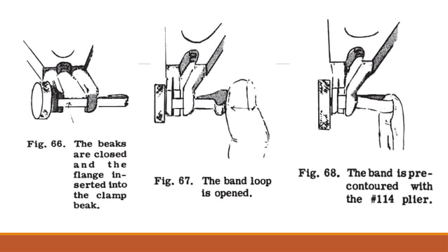 ORTHO BANDS.pptx vgghj hgjbk bk bjk j nk,n,jk | PPT