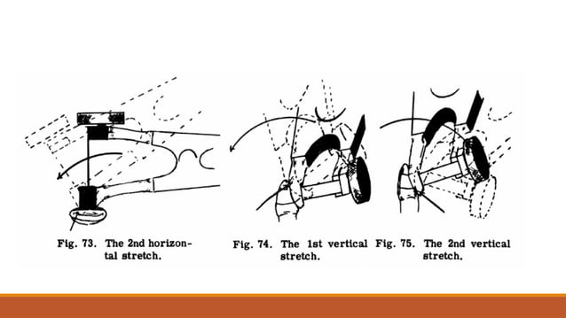 ORTHO BANDS.pptx vgghj hgjbk bk bjk j nk,n,jk | PPT