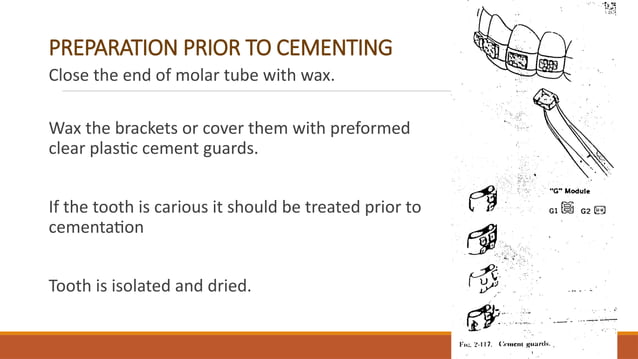 ORTHO BANDS.pptx vgghj hgjbk bk bjk j nk,n,jk | PPT