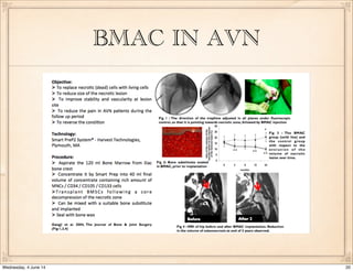 Orthobiologics - PRP, BMC the real story so far! | PDF
