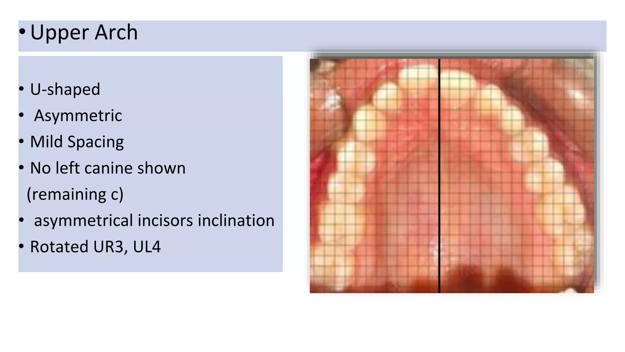 orthodontic case presentation | PPTX