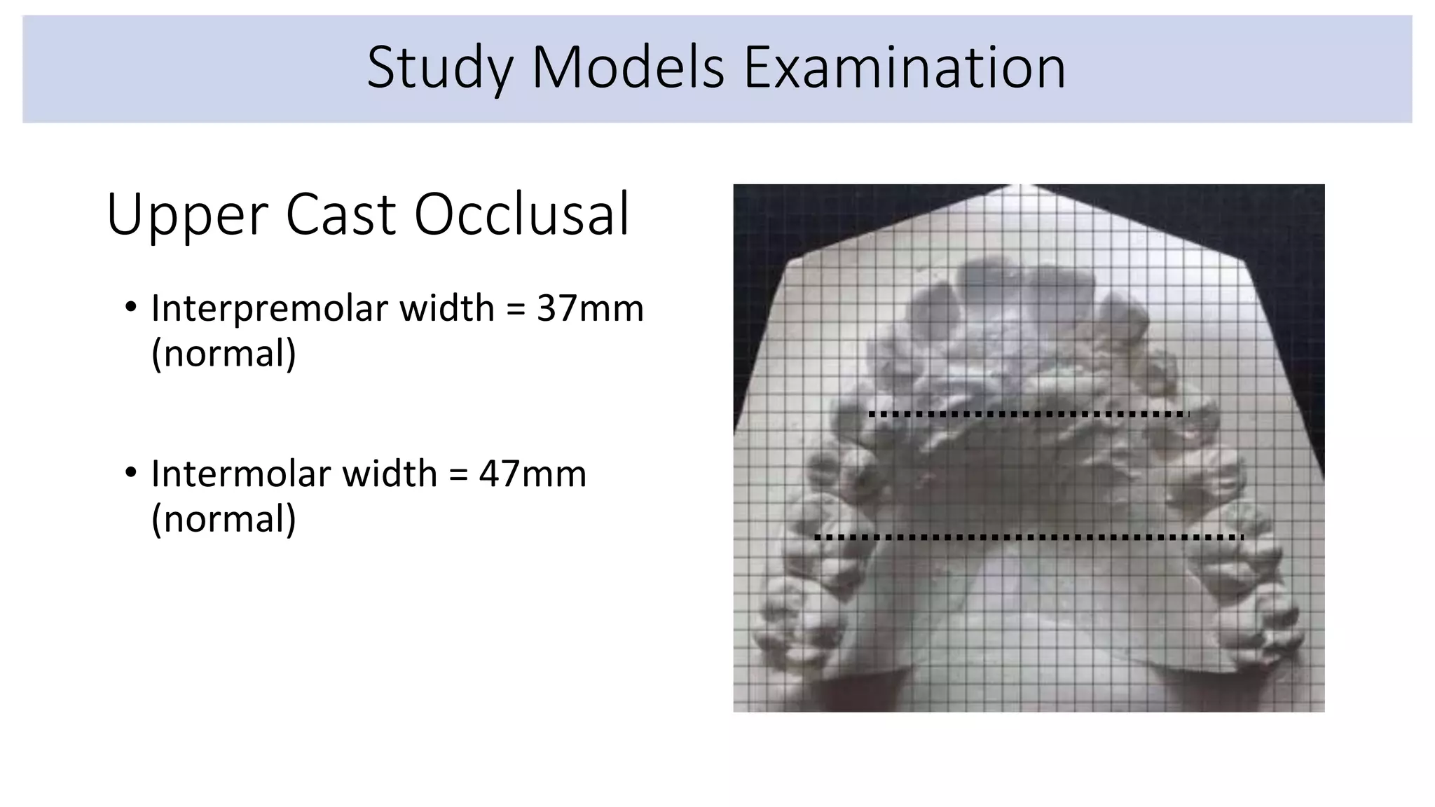 orthodontic case presentation | PPTX