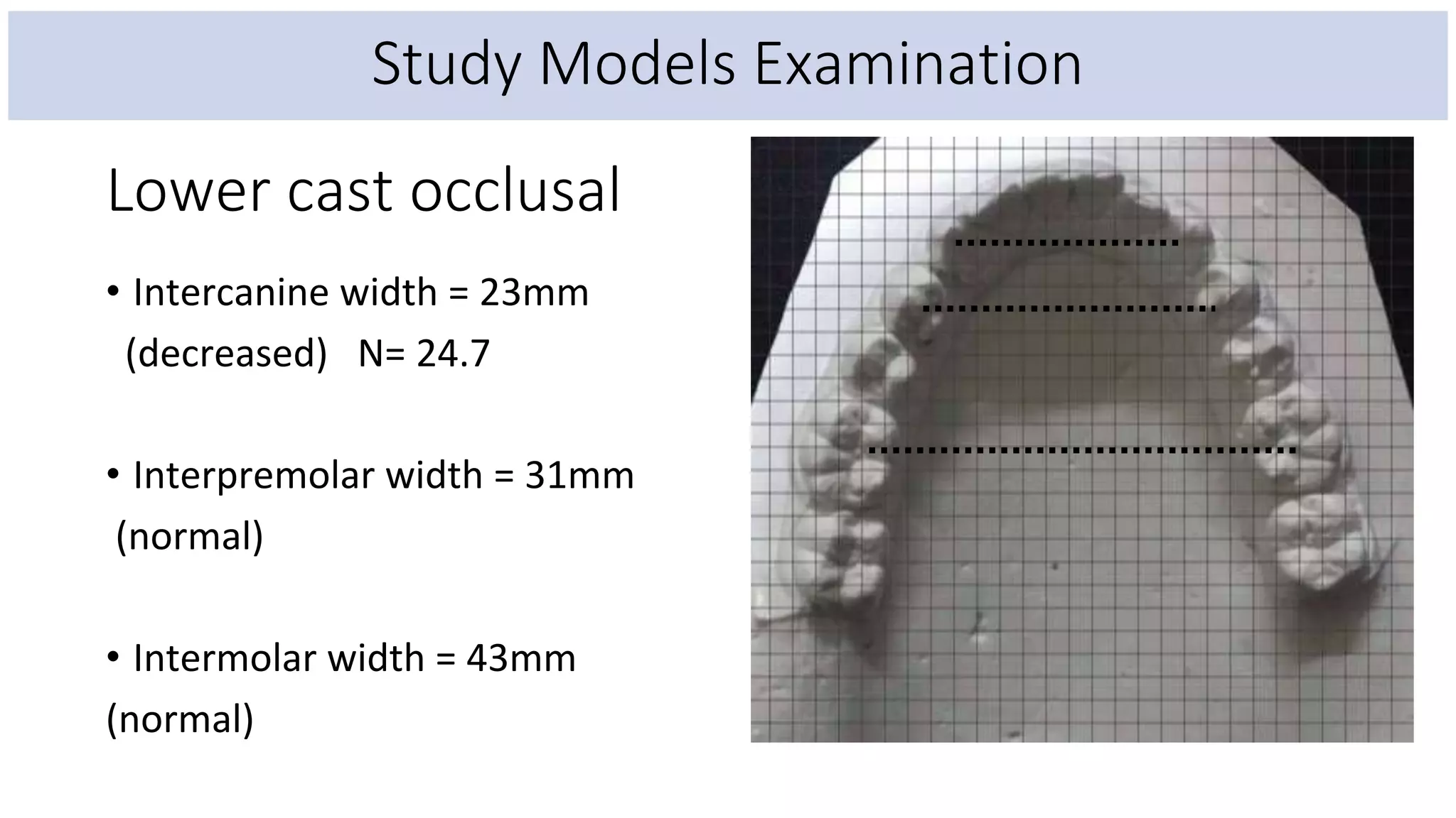 orthodontic case presentation | PPTX