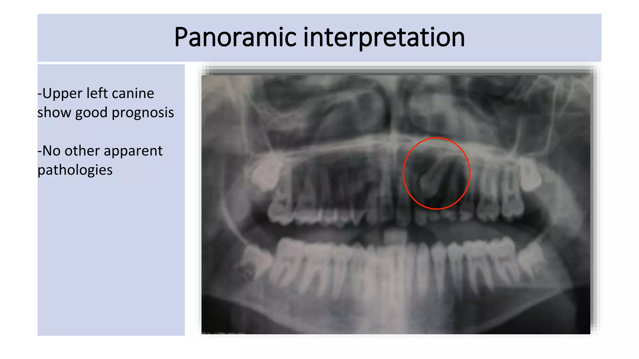 orthodontic case presentation | PPTX