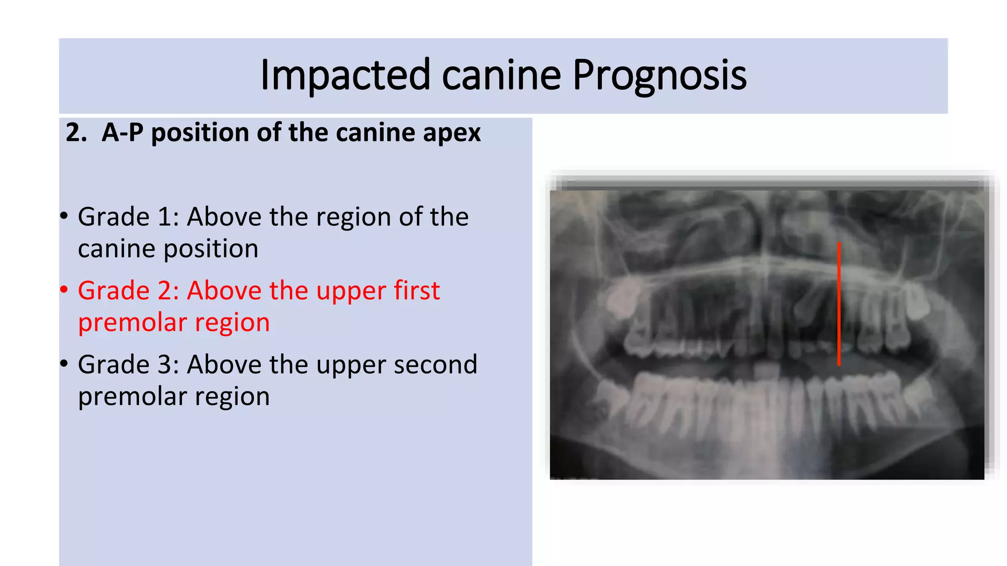 orthodontic case presentation | PPTX