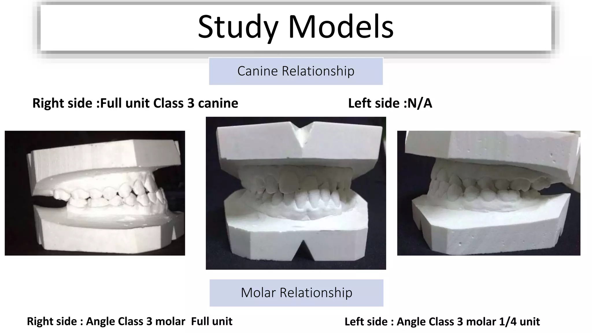 orthodontic case presentation | PPTX
