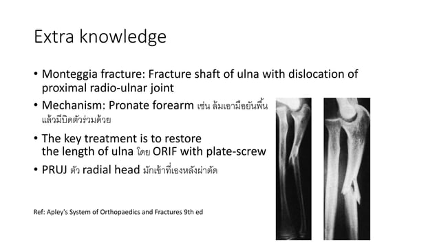 Ortho case discussion | PPTX