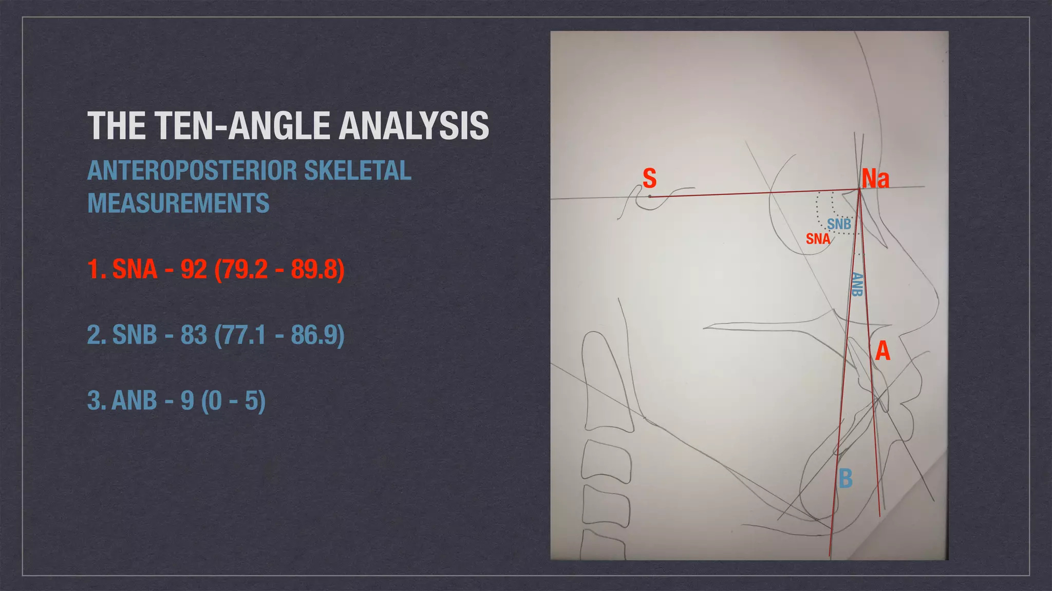 Orthodontics and Dentofacial Orthopedics Case Analysis | PDF