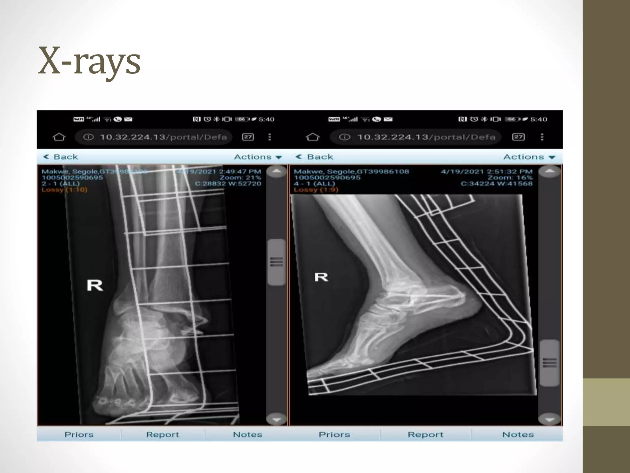 ORTHO CASE STUDY final.pptx