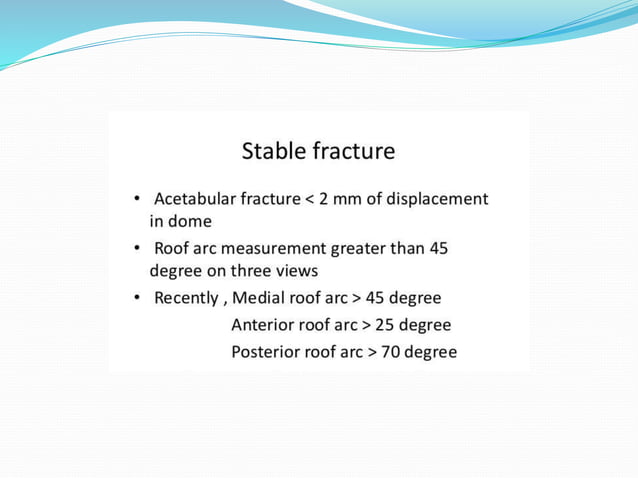acetabulum fracture orthocon 2018 | PPT