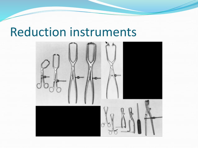 acetabulum fracture orthocon 2018 | PPT