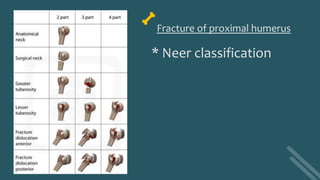 Ortho conference - anterior shoulder dislocation | PPTX