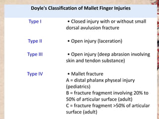 Mallet finger | PPTX