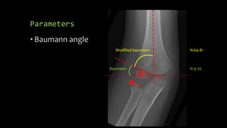 Ortho con supra copy | PPT