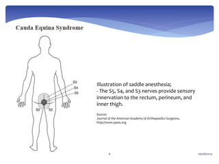 Conus medullaris and cauda equina syndrome | PPTX