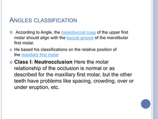 Orthodontics clasificacion de Angle Método Herbz | PPT