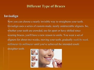 Orthodontic Procedures Presentation | PPT | Dental Health | Diseases ...