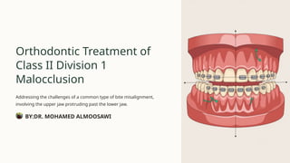 Orthodontic-Treatment-of-Class-II-Division-1-Malocclusion.pptx