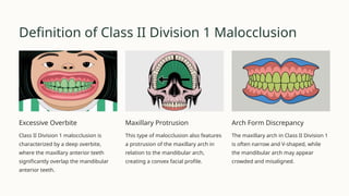 Orthodontic-Treatment-of-Class-II-Division-1-Malocclusion.pptx