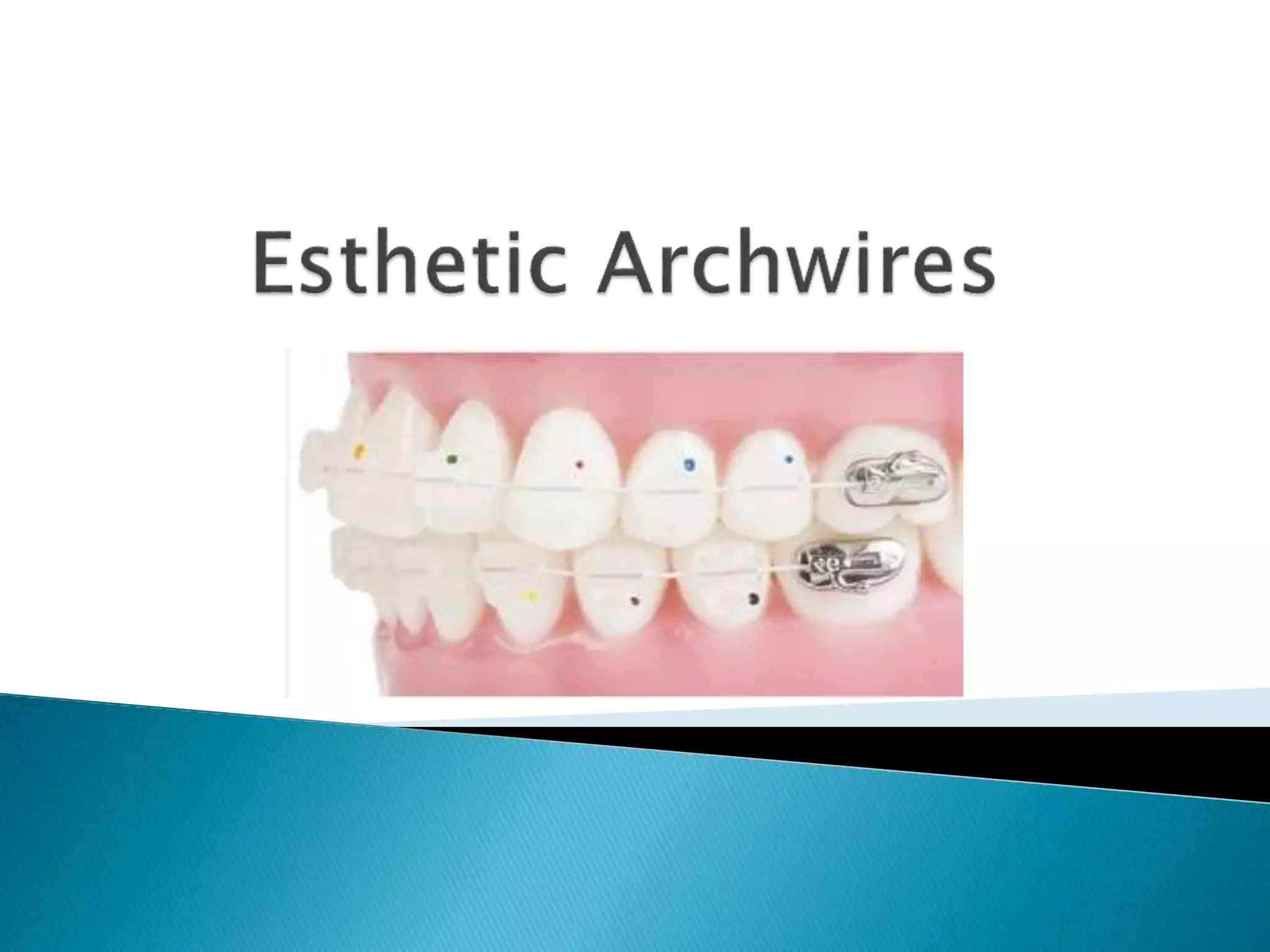 Orthodontic-wires ppt | PPT
