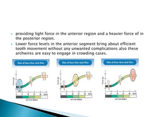Orthodontic-wires ppt | PPT