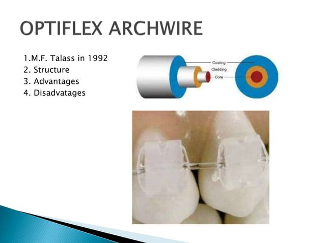 Orthodontic-wires ppt | PPT | Dental Health | Diseases and Conditions