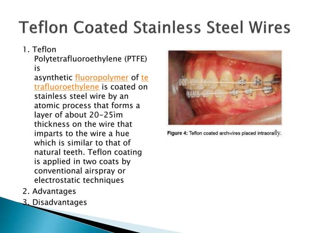 Orthodontic-wires ppt | PPT | Dental Health | Diseases and Conditions