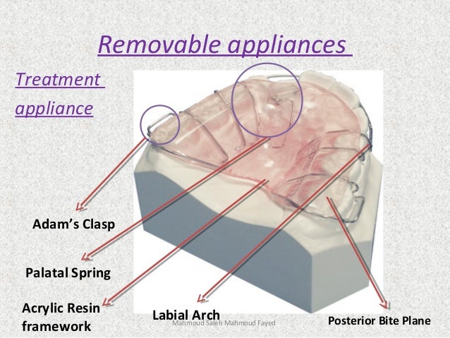 Orthodontic appliances