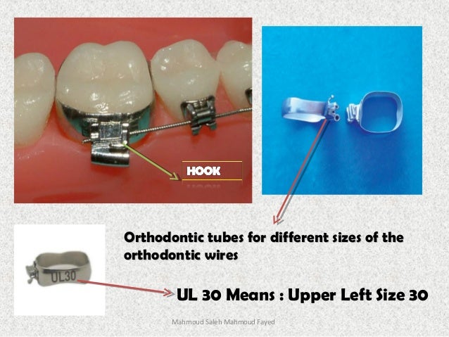 Orthodontic appliances