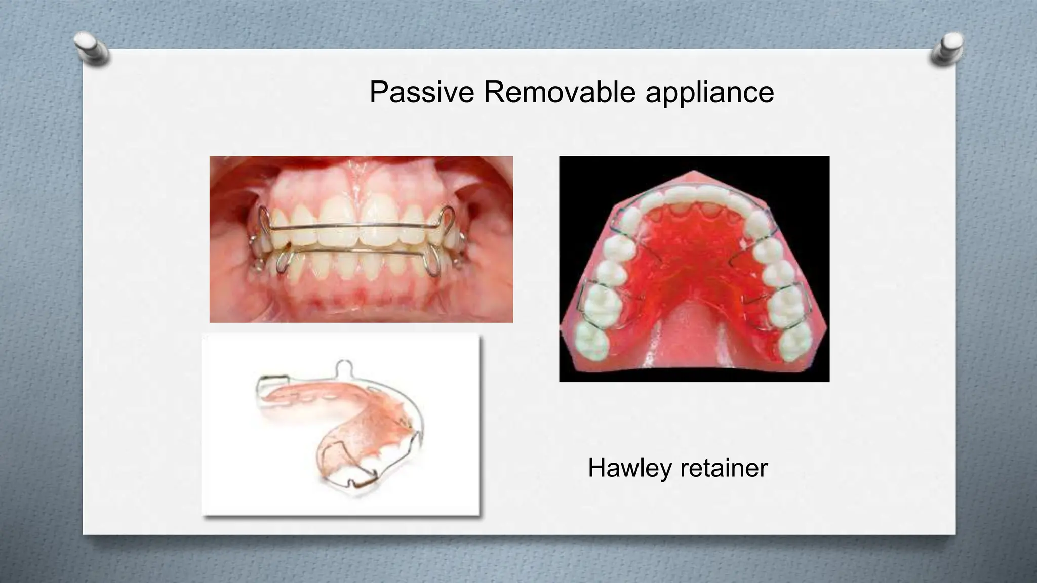 Orthodontic Appliances | PPTX