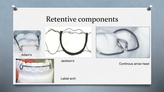 Orthodontic Appliances | PPTX