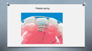 Orthodontic Appliances | PPTX