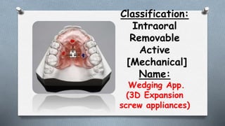 Orthodontic Appliances | PPTX