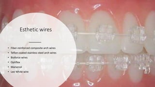 Orthodontics archwaire & treatment plan | PPT