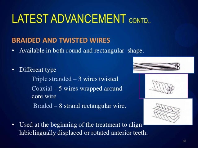 Orthodontic archwires