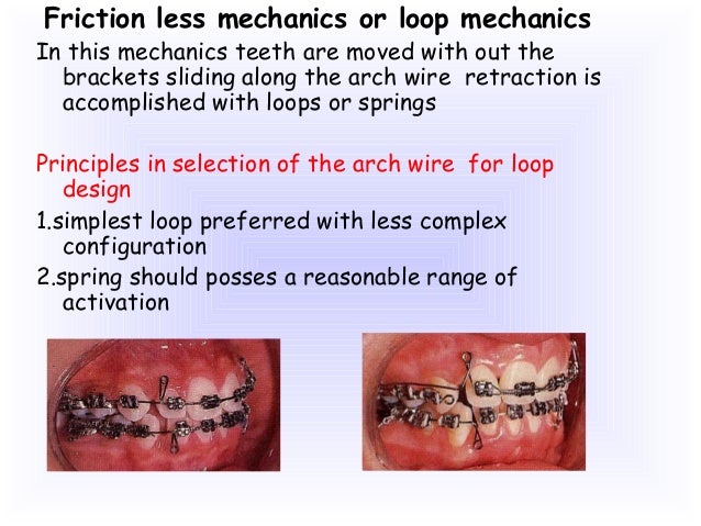 Orthodontic arch wirs ii