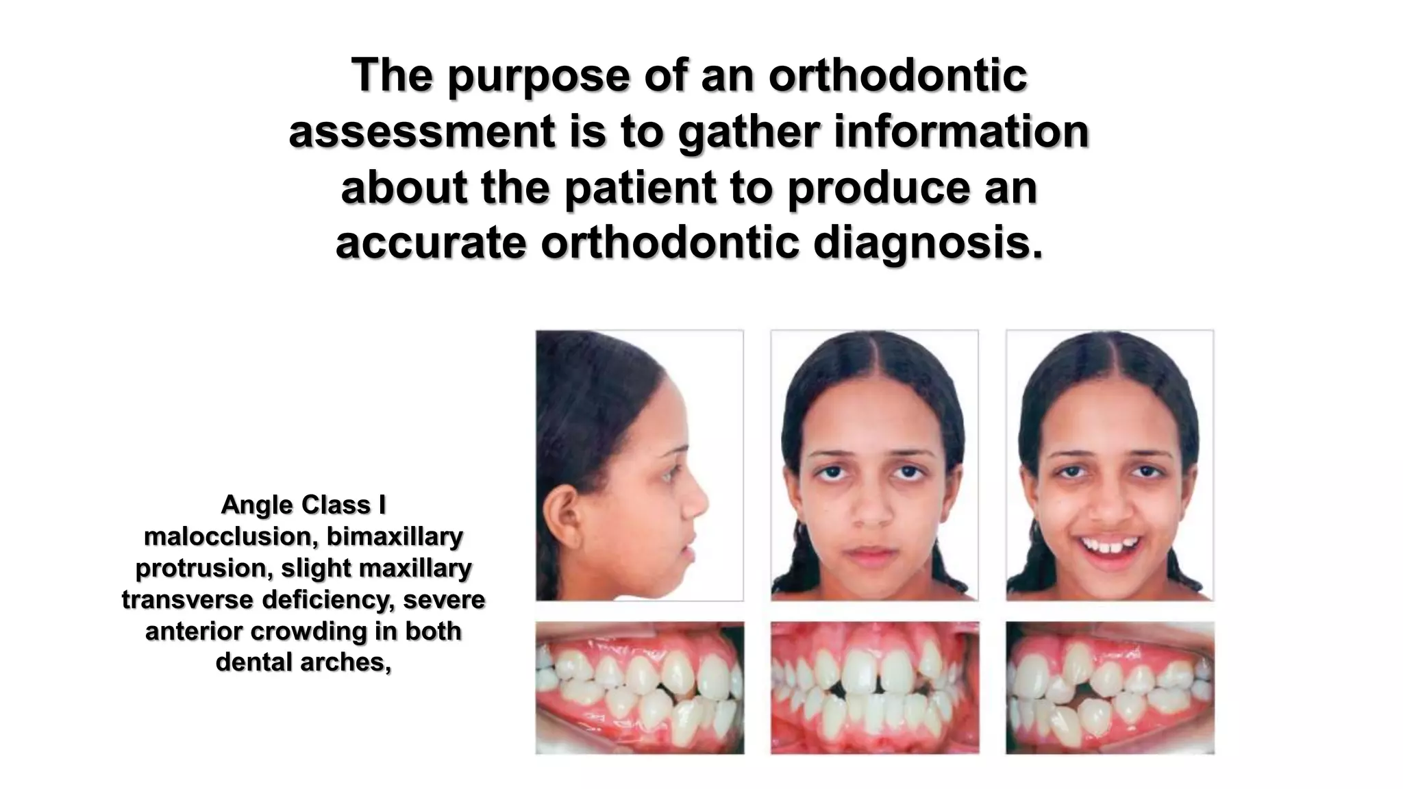 Orthodontic assessment of the patient | PPTX