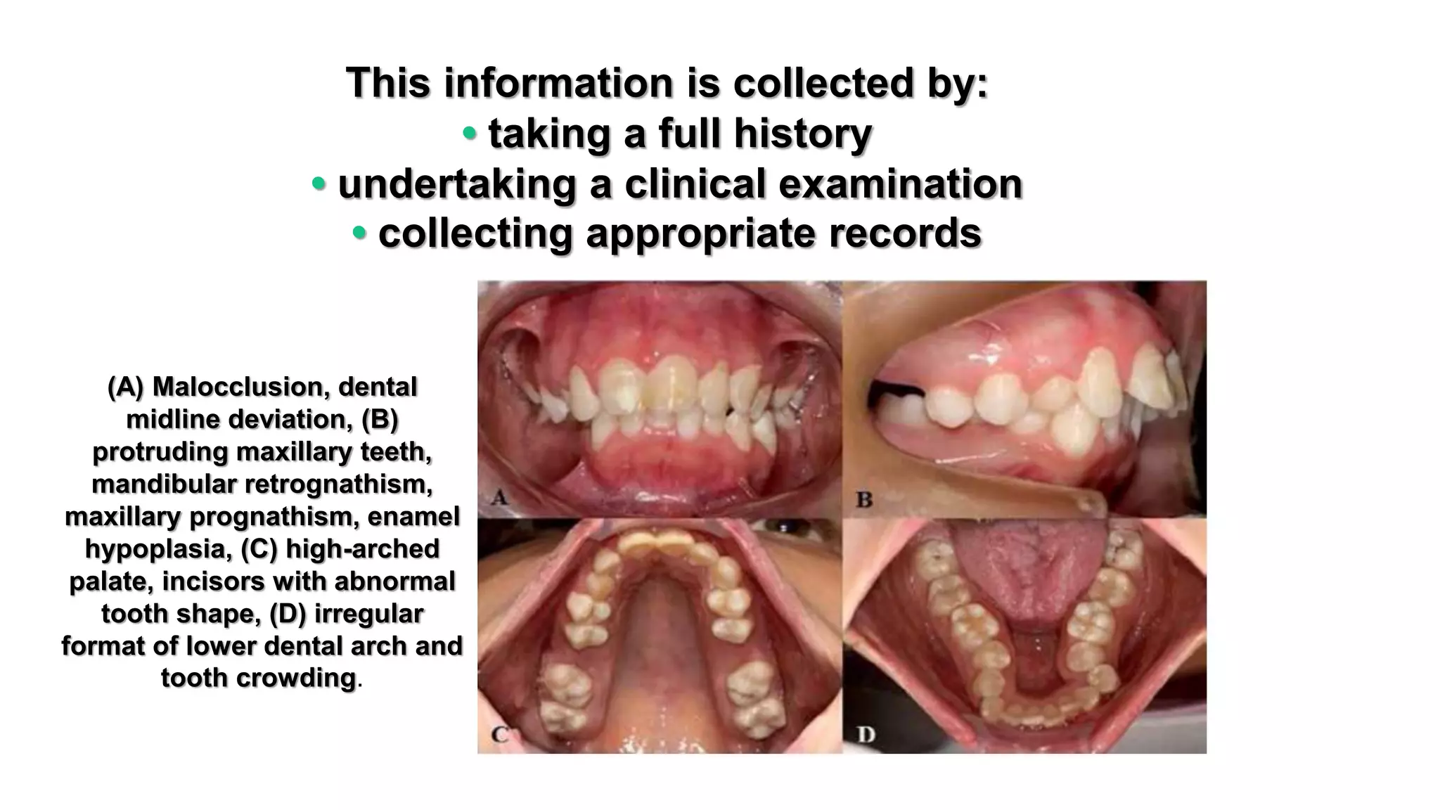 Orthodontic assessment of the patient | PPTX