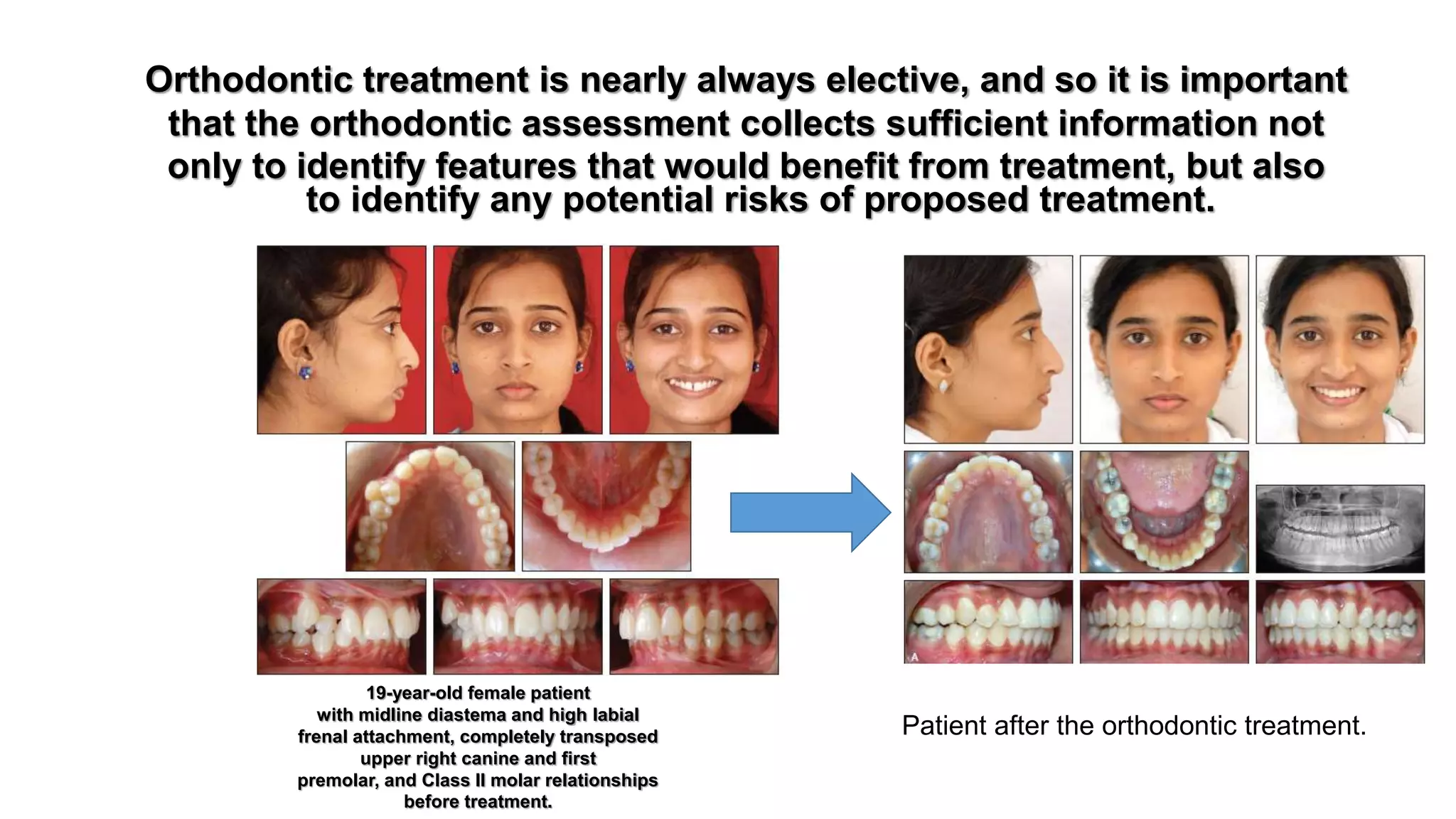 Orthodontic assessment of the patient | PPTX