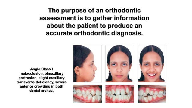 Orthodontic assessment of the patient | PPTX | Dental Health | Diseases ...