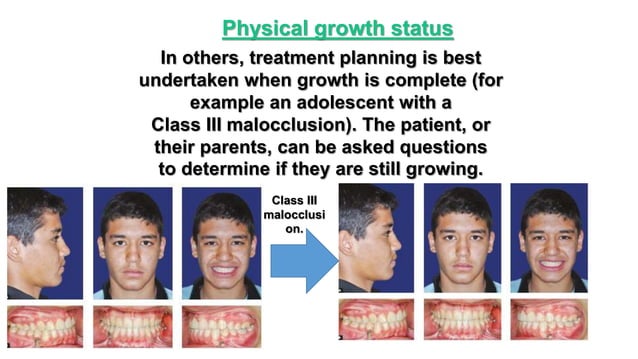 Orthodontic assessment of the patient | PPTX | Dental Health | Diseases ...