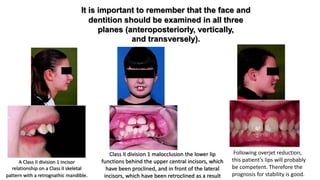Orthodontic assessment of the patient | PPTX