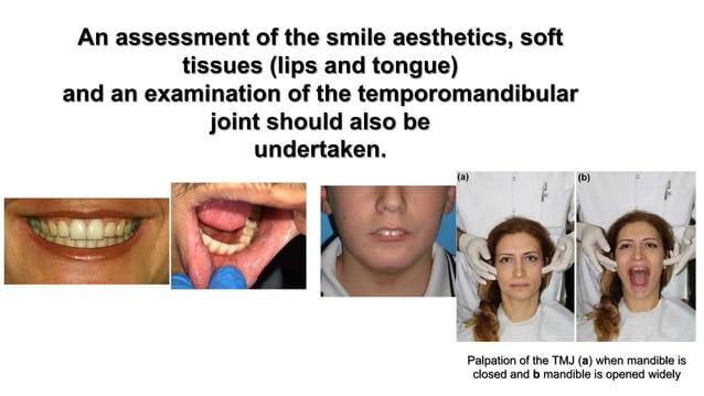 Orthodontic assessment of the patient | PPTX | Dental Health | Diseases ...